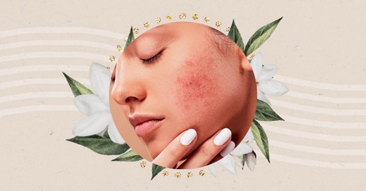 Exploring The Difference Between Sensitive & Sensitized Skin