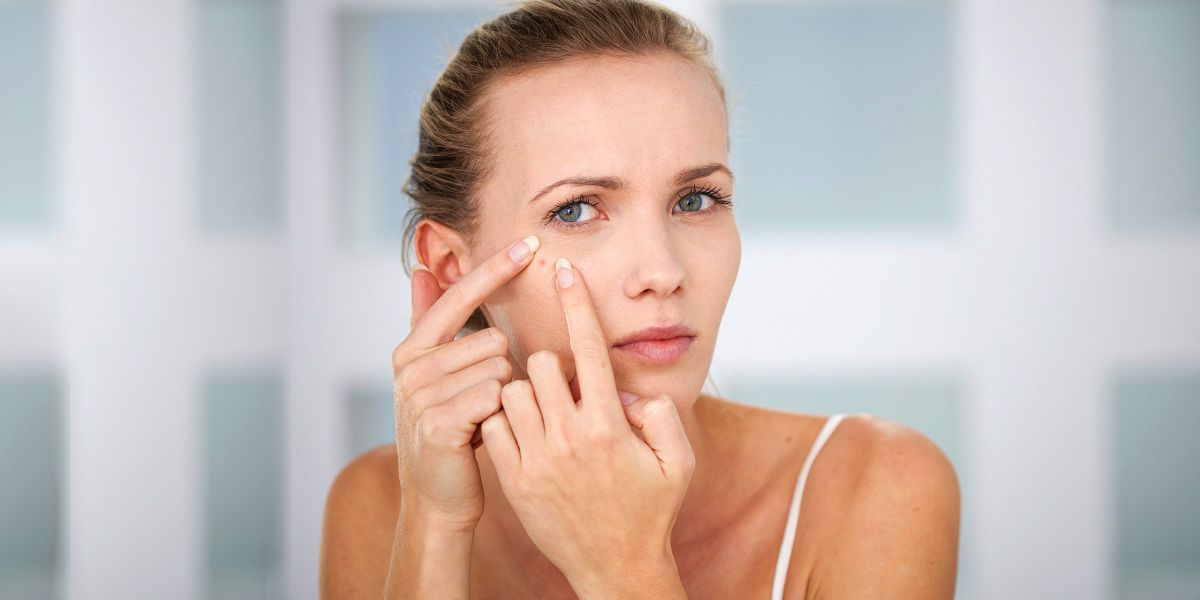 Why Skin Breaks Out after a Facial & How to Choose the Right Aftercare